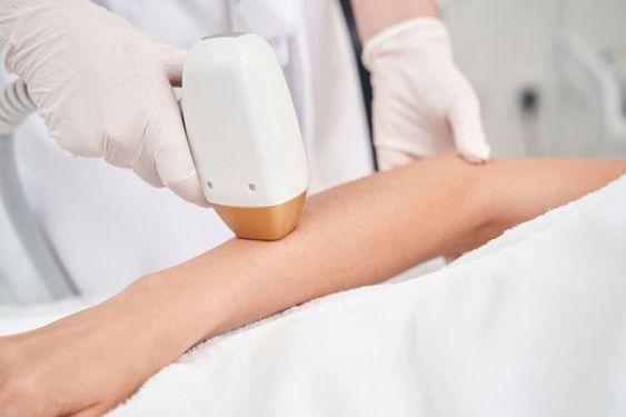 TopHealthanswers - Laser Hair Removal: What to Know TopHealthanswers - Laser Hair Removal: What to Know